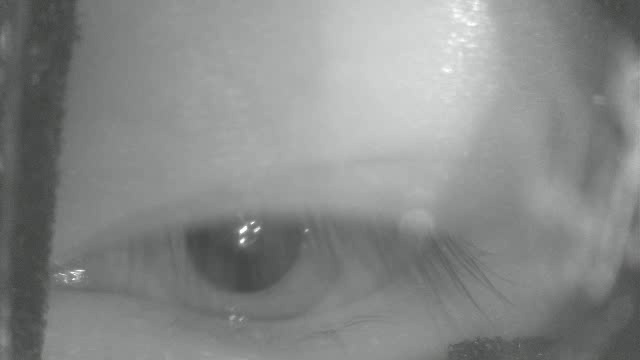 EYE Object Detection Dataset by CHENG YAO