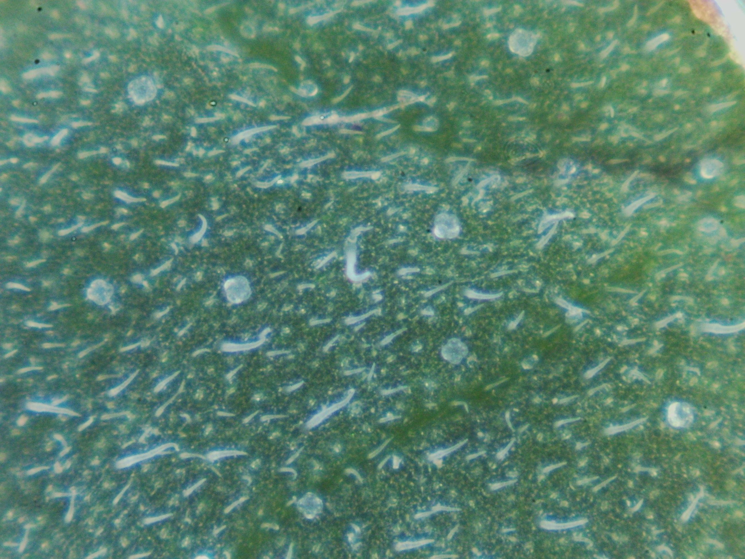 Trichome Project 1 Object Detection Dataset And Pre Trained Model By Christian Albrecht University