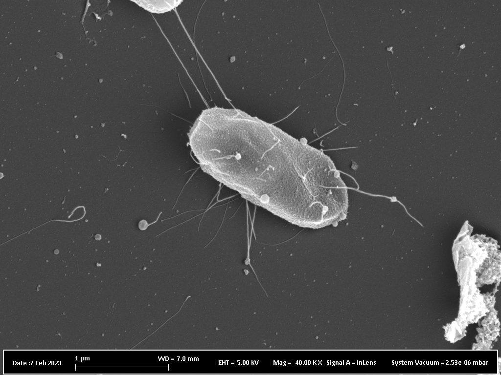 SEM Image Instance Segmentation Dataset by Umu