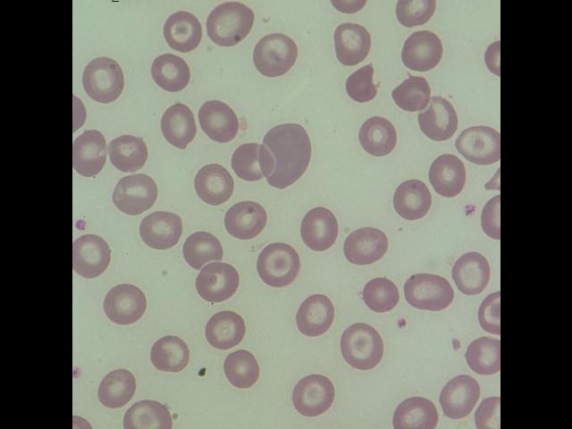 Chula x BCCD Object Detection Dataset by Vaccshift