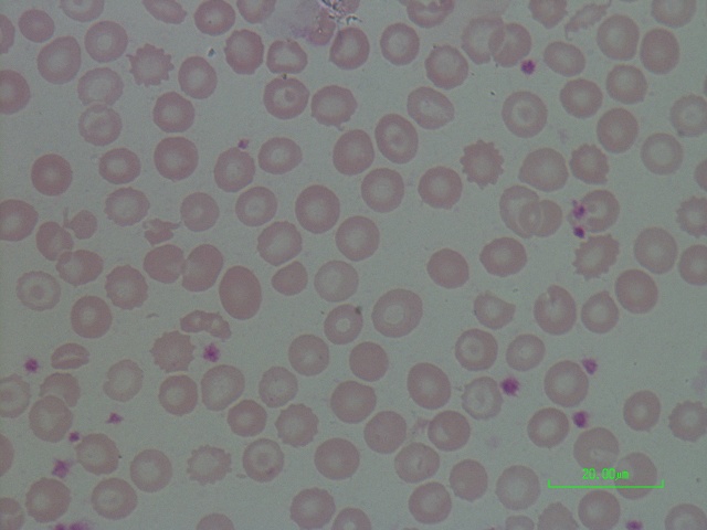 Blood Cells - Chula Object Detection Dataset by Vaccshift