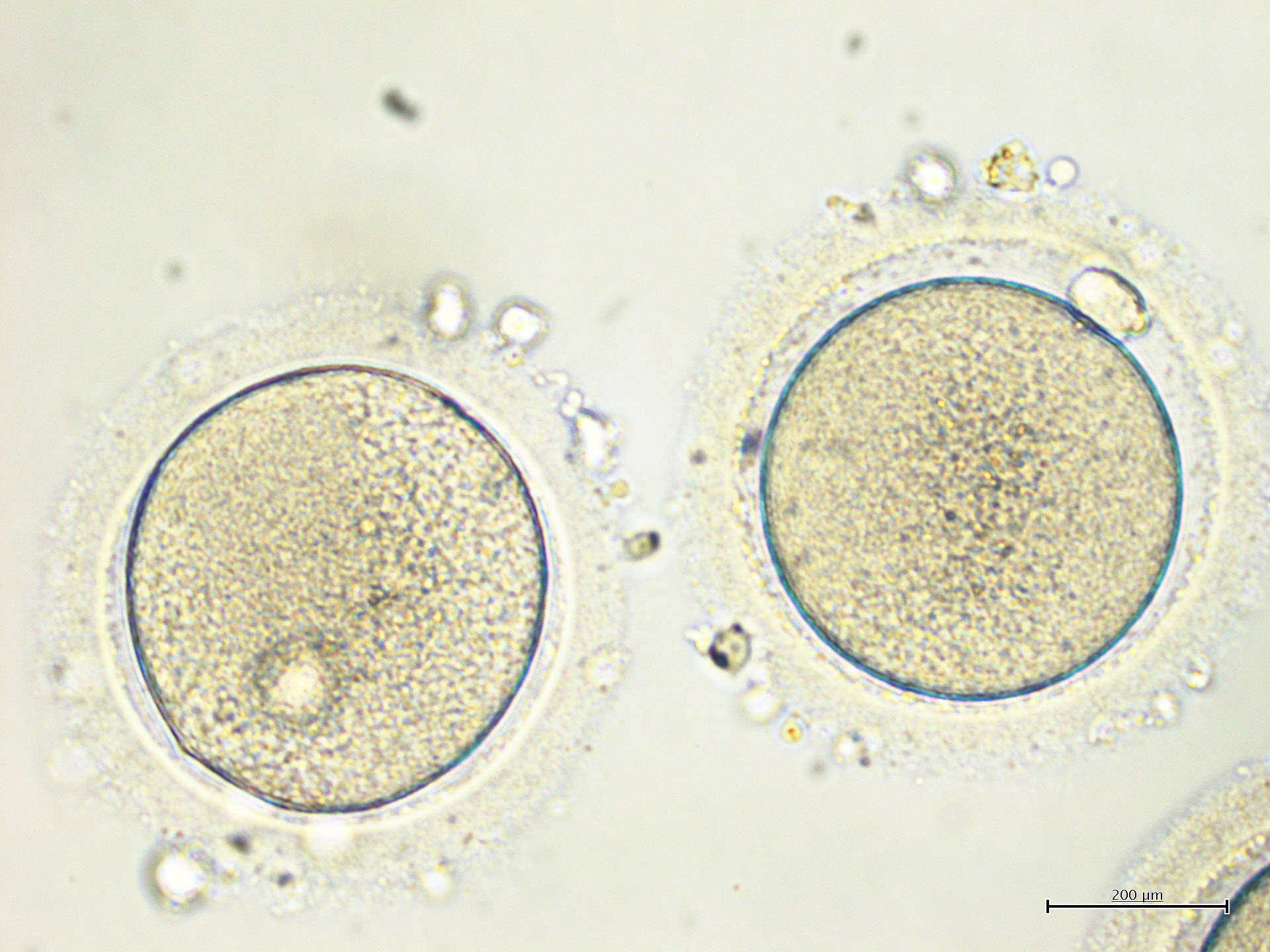 Oocyte Recognition Object Detection Dataset and Pre-Trained Model by Oocyte Detection