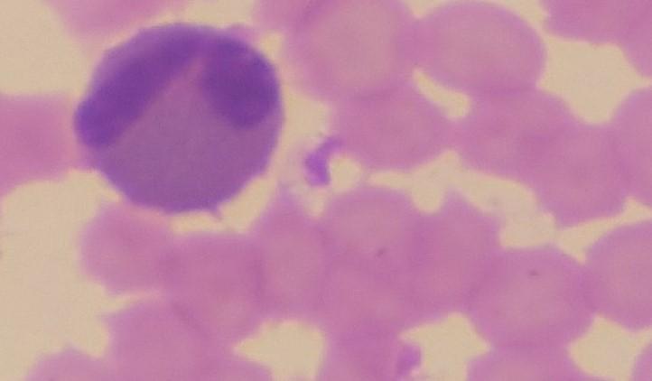 WBC_2 Object Detection Dataset by project-6blex