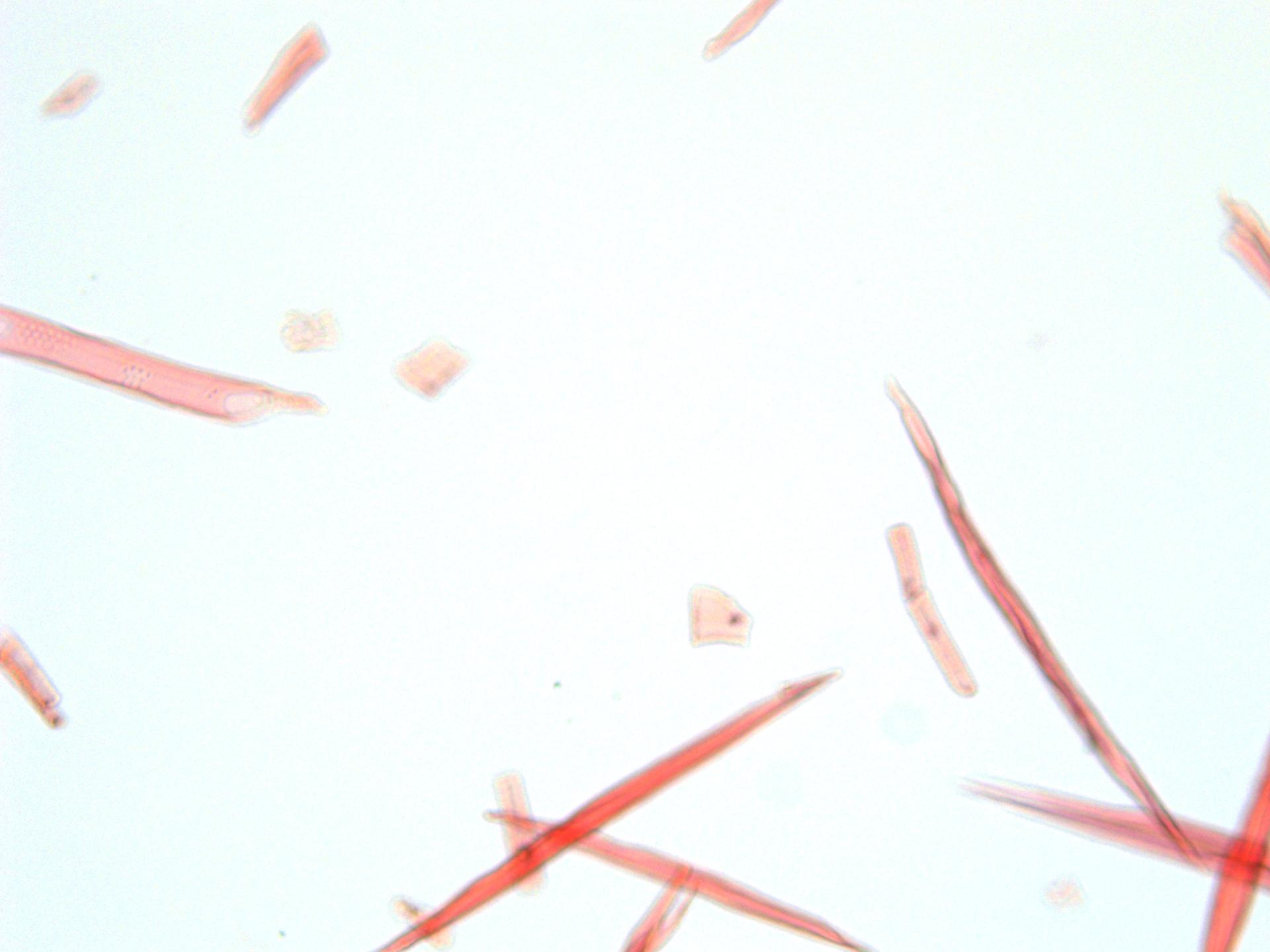 wood val2 Instance Segmentation Dataset by check