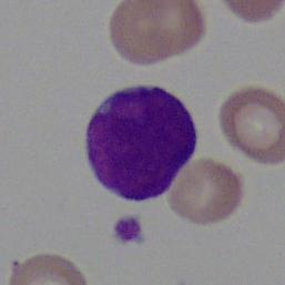 Leukemia Detection 3 Object Detection Dataset and Pre-Trained Model by ...