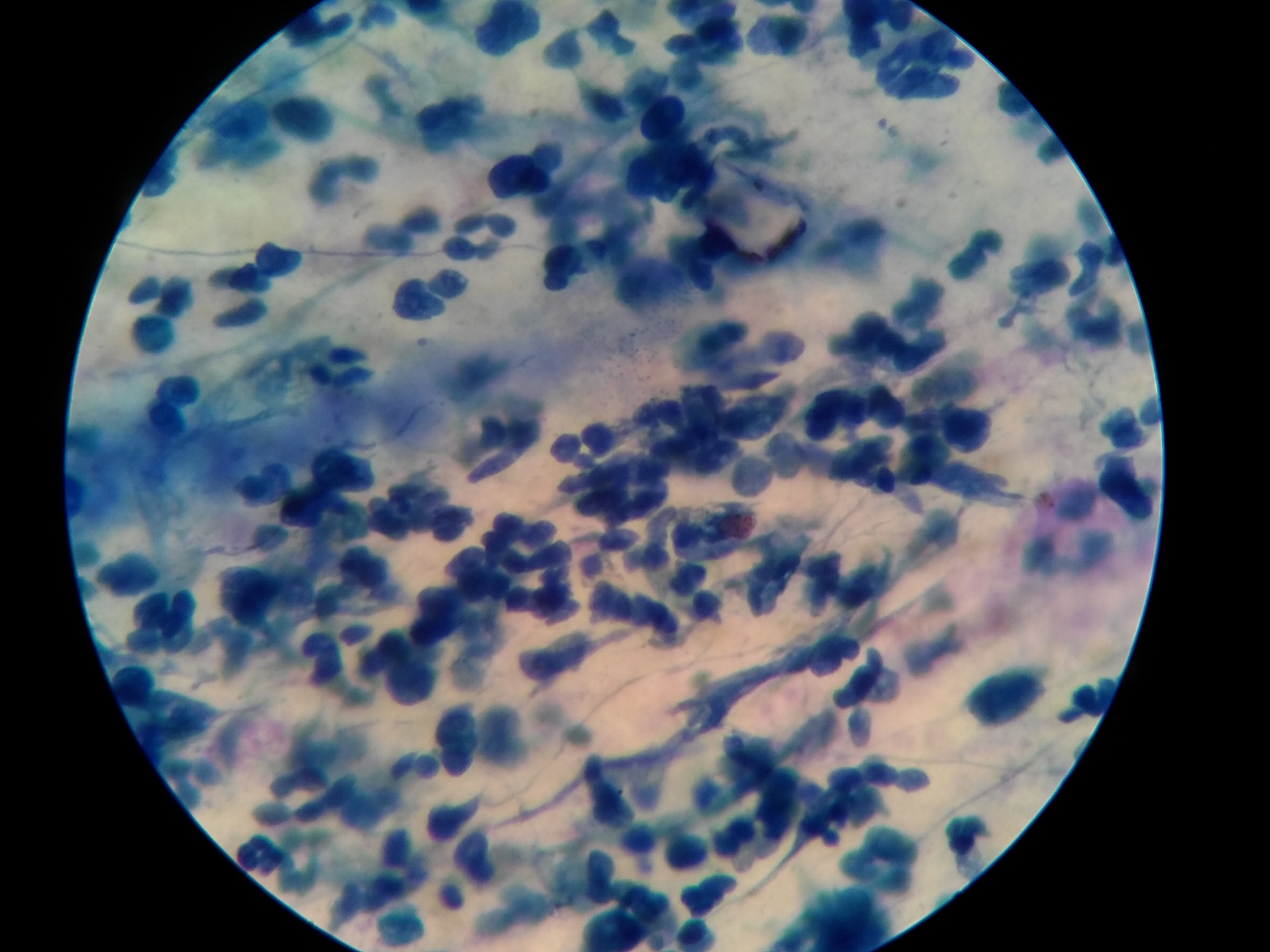 Bacteria Testing Object Detection Dataset by tuberculosis