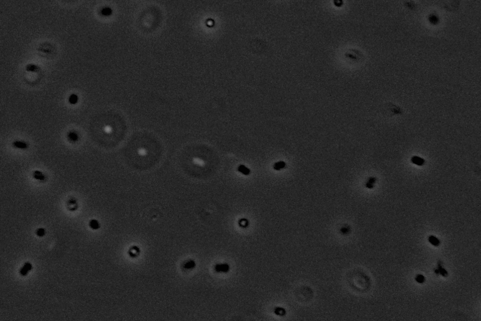 Detection bacter GRAY Object Detection Dataset and Pre-Trained Model by ...