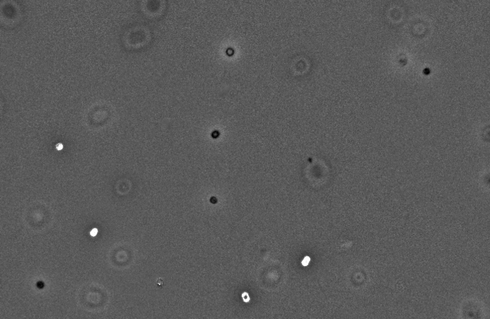 Detection Bacter Diff Object Detection Dataset By Maxim