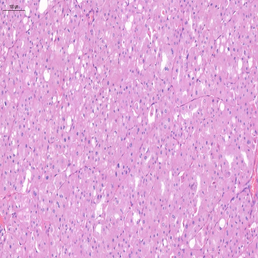 m Classification Dataset (v1, data) by new-workspace-0o0qo