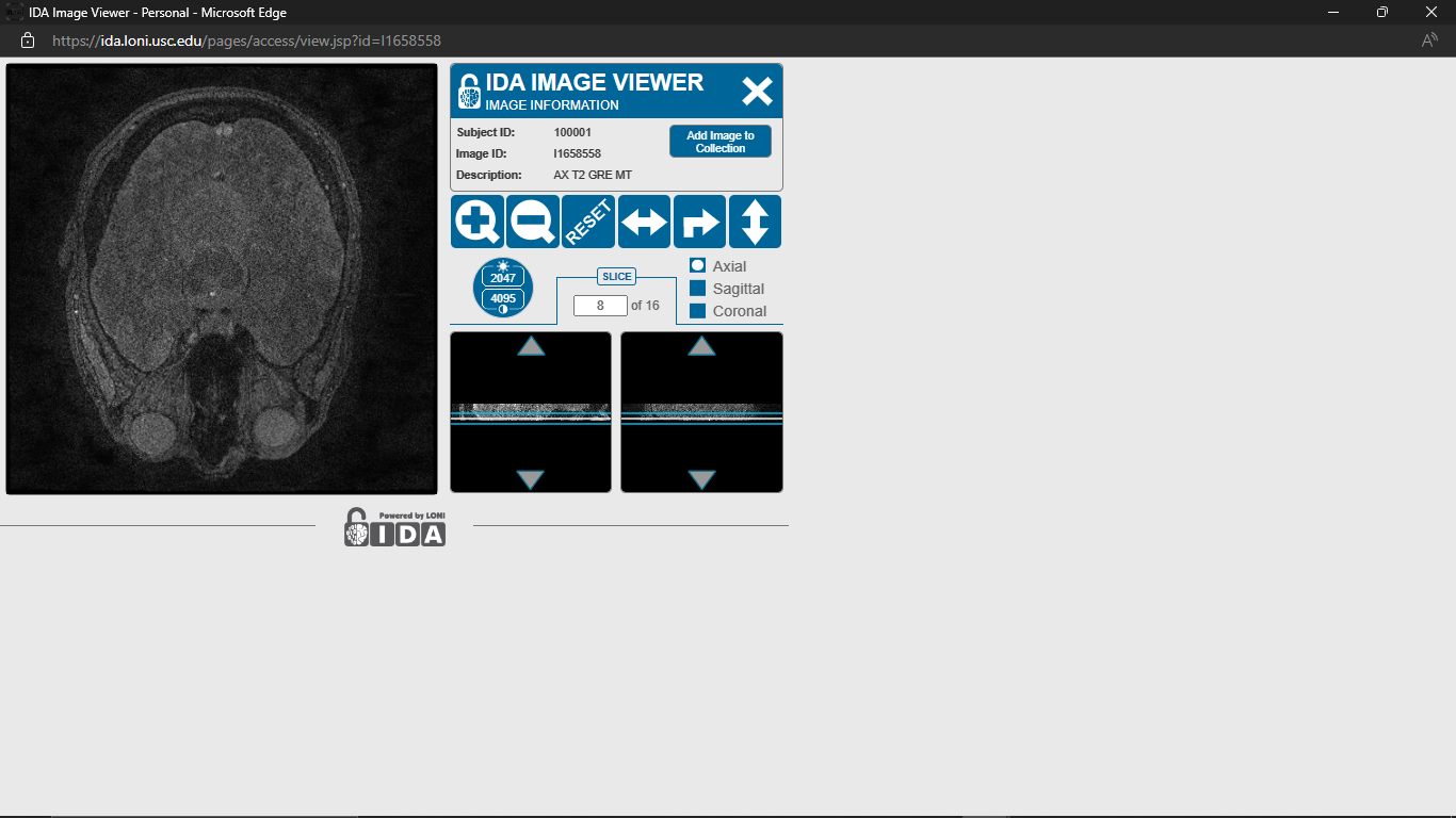 USC Parkinsons mri Object Detection Dataset and Pre-Trained Model by tks