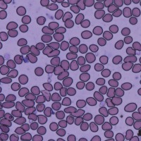 White blood cells detection Object Detection Dataset and Pre-Trained ...