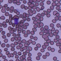 White blood cells detection Object Detection Dataset and Pre-Trained ...