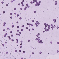 blood-smear-classification Classification Dataset and Pre-Trained Model ...