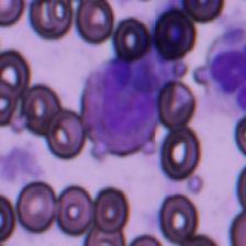 wbc-bounding-box Object Detection Dataset and Pre-Trained Model by SMack Lab