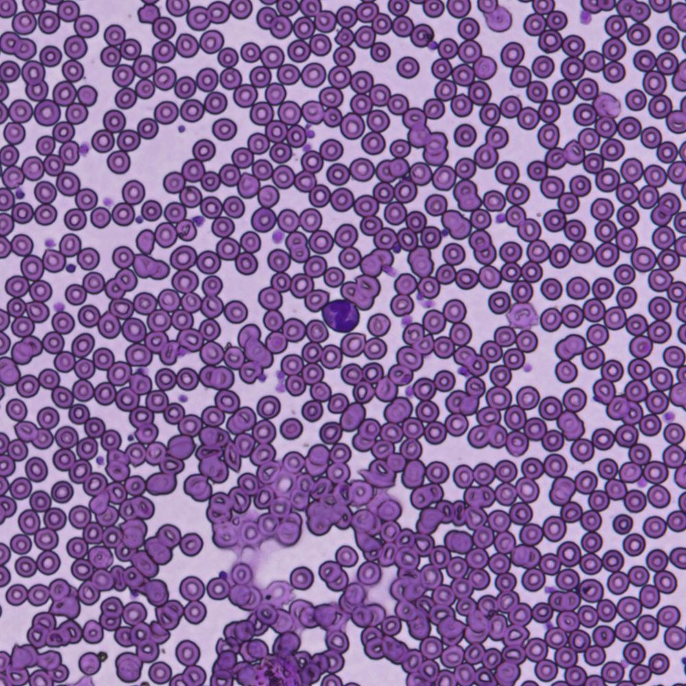 blood-smear-classification Classification Dataset and Pre-Trained Model ...
