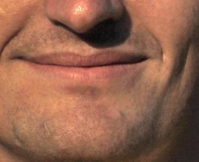 Skin Classification Classification Dataset by school