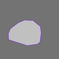 YOLOv8-Pothole Object Detection Dataset and Pre-Trained Model by umkc