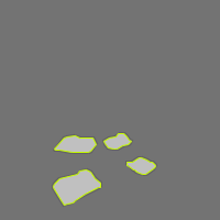 YOLOv8-Pothole Object Detection Dataset and Pre-Trained Model by umkc