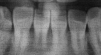 BOUNDING BOX Object Detection Dataset and Pre-Trained Model by BioMET