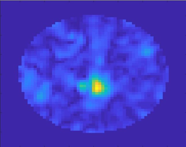 Tumor Object Detection Dataset V1 2022 09 26 2 28pm By Srm