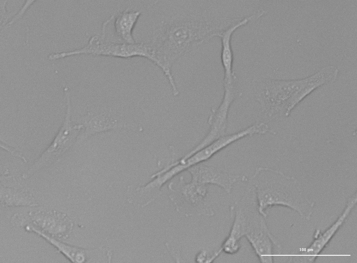 How to Use the TNT Quantification Object Detection API