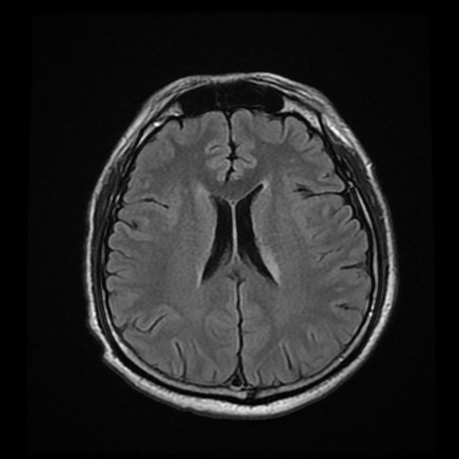 Flair 433 Object Detection Dataset by FLAIRDataset