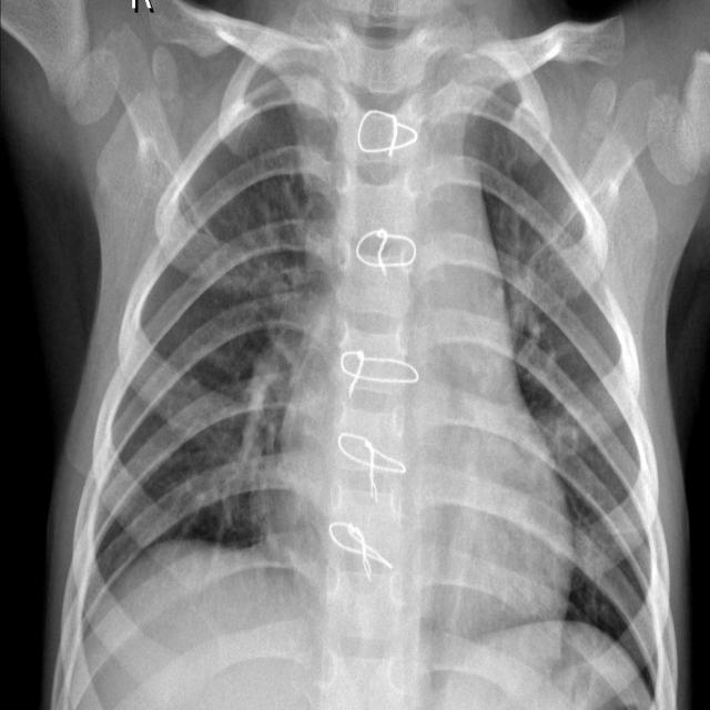 x-ray_project Classification Dataset by buksu