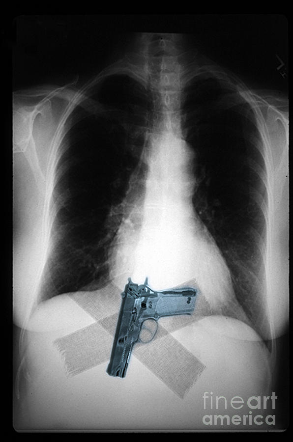 guns_xray Object Detection Dataset by top2