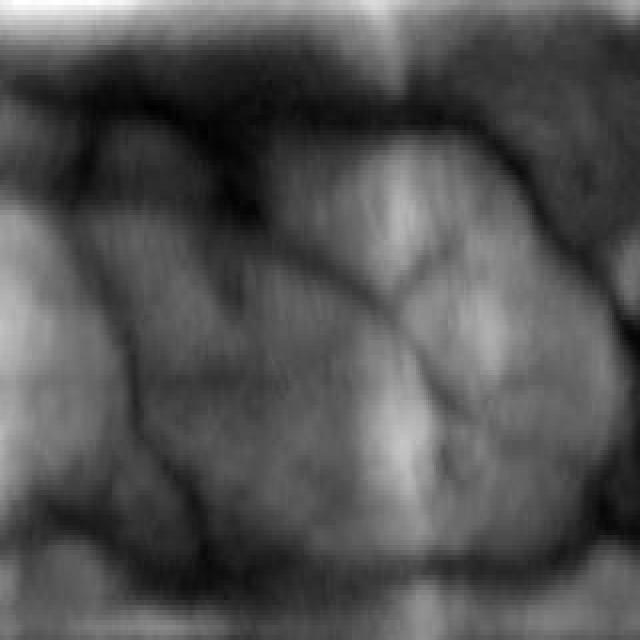 Veins Object Detection Dataset By Project1