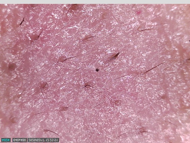 skin classification Classification Dataset and Pre-Trained Model by ciputra