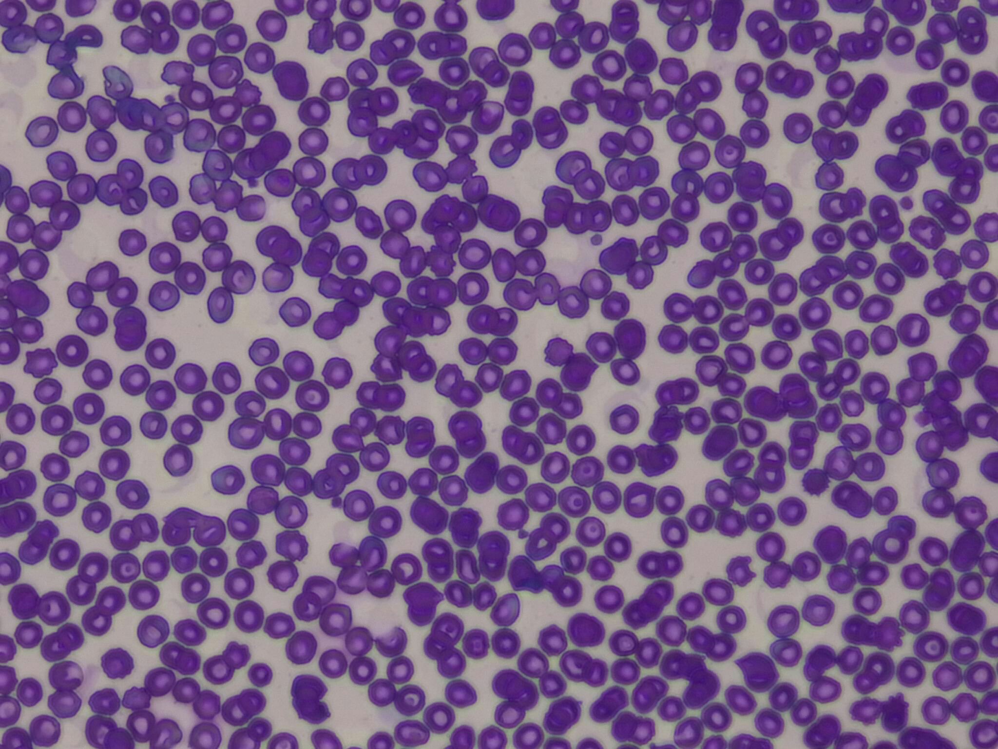 Blood cells object detection Object Detection Dataset and Pre-Trained Model by realtimeprojects