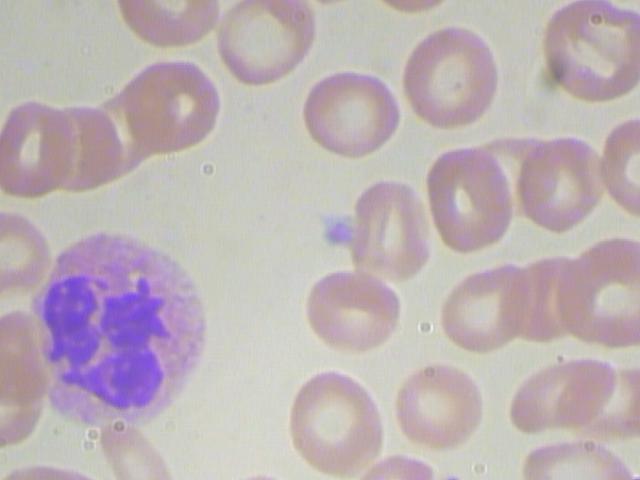 BCCD Object Detection Dataset by new-workspace-ff5m9