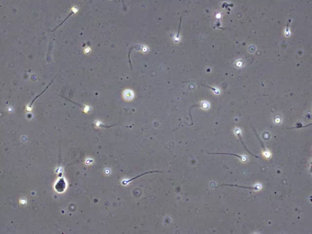 Sperm Detection VISEM Object Detection Dataset by Kate Nguyen