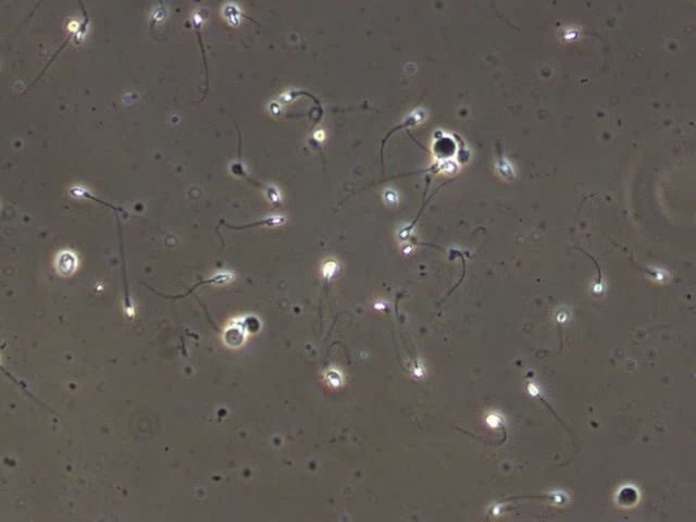 How to Use the Sperm Detection VISEM Object Detection API