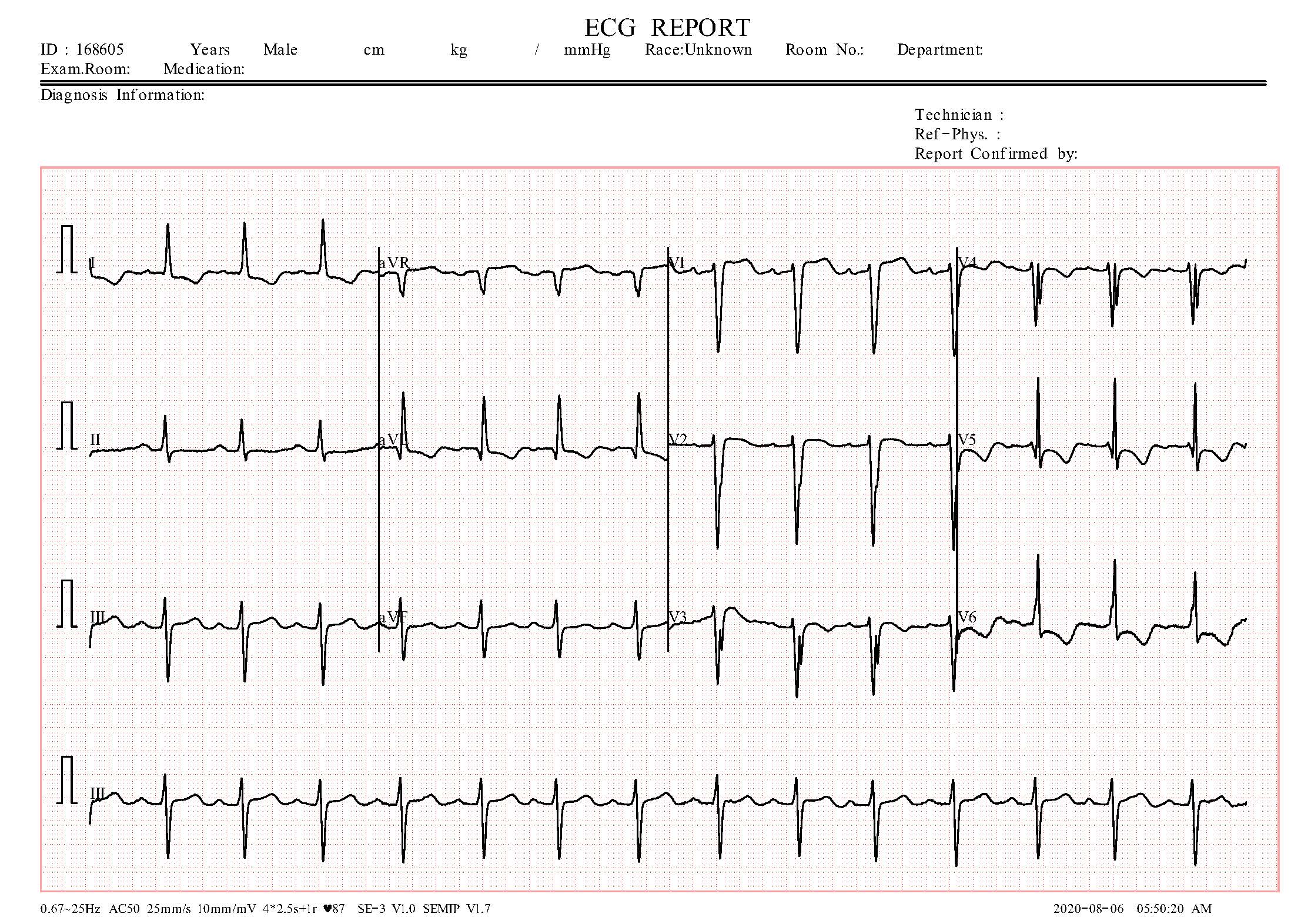 ecg Classification Dataset by ecg
