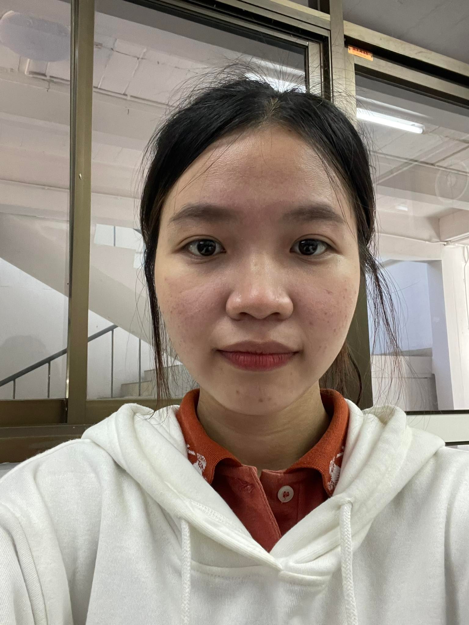SP2 Object Detection Dataset And Pre Trained Model By Puripongroboflow