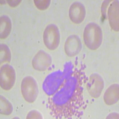 YOLO custom Object Detection Dataset by Solomon vandy