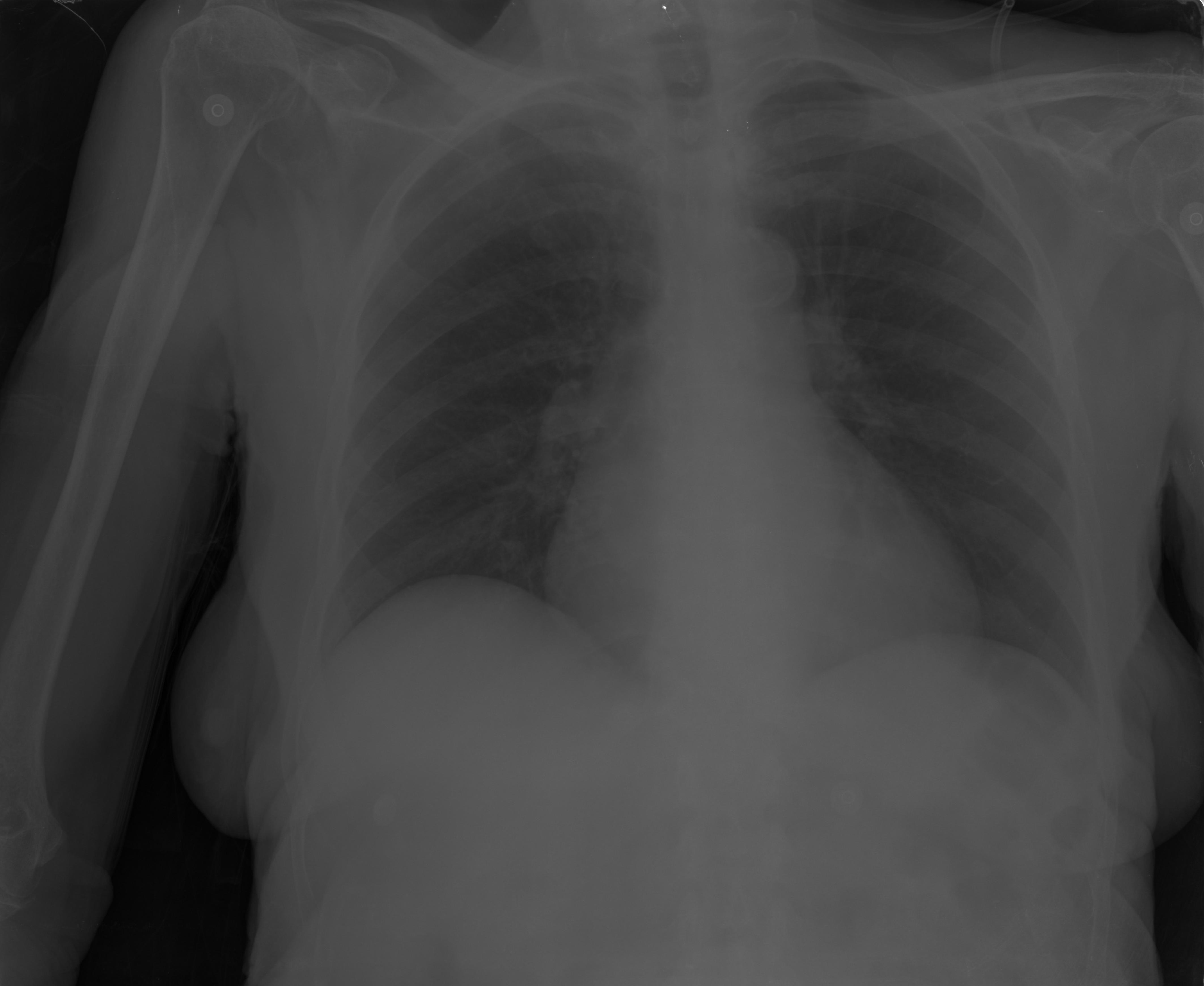 X-Ray Images Sample Object Detection Dataset by Saint Josephs University